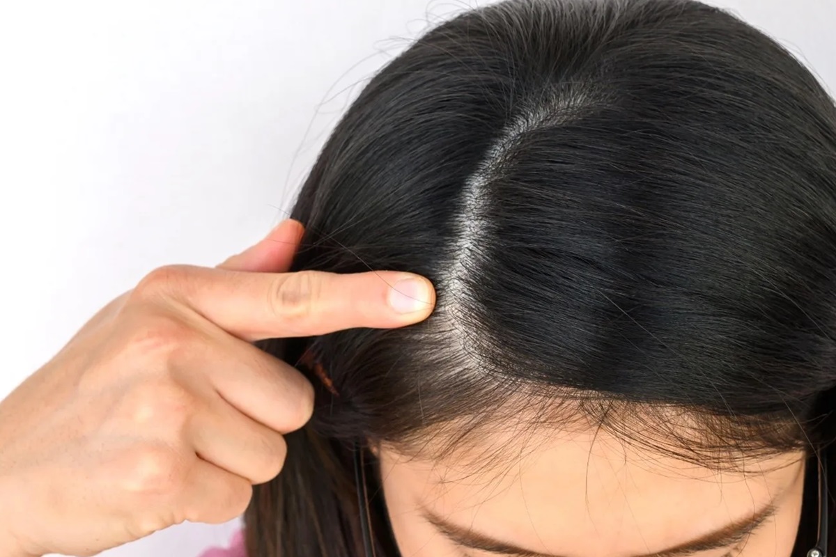 Five Solutions Your Scalp Is Craving - The News Pit
